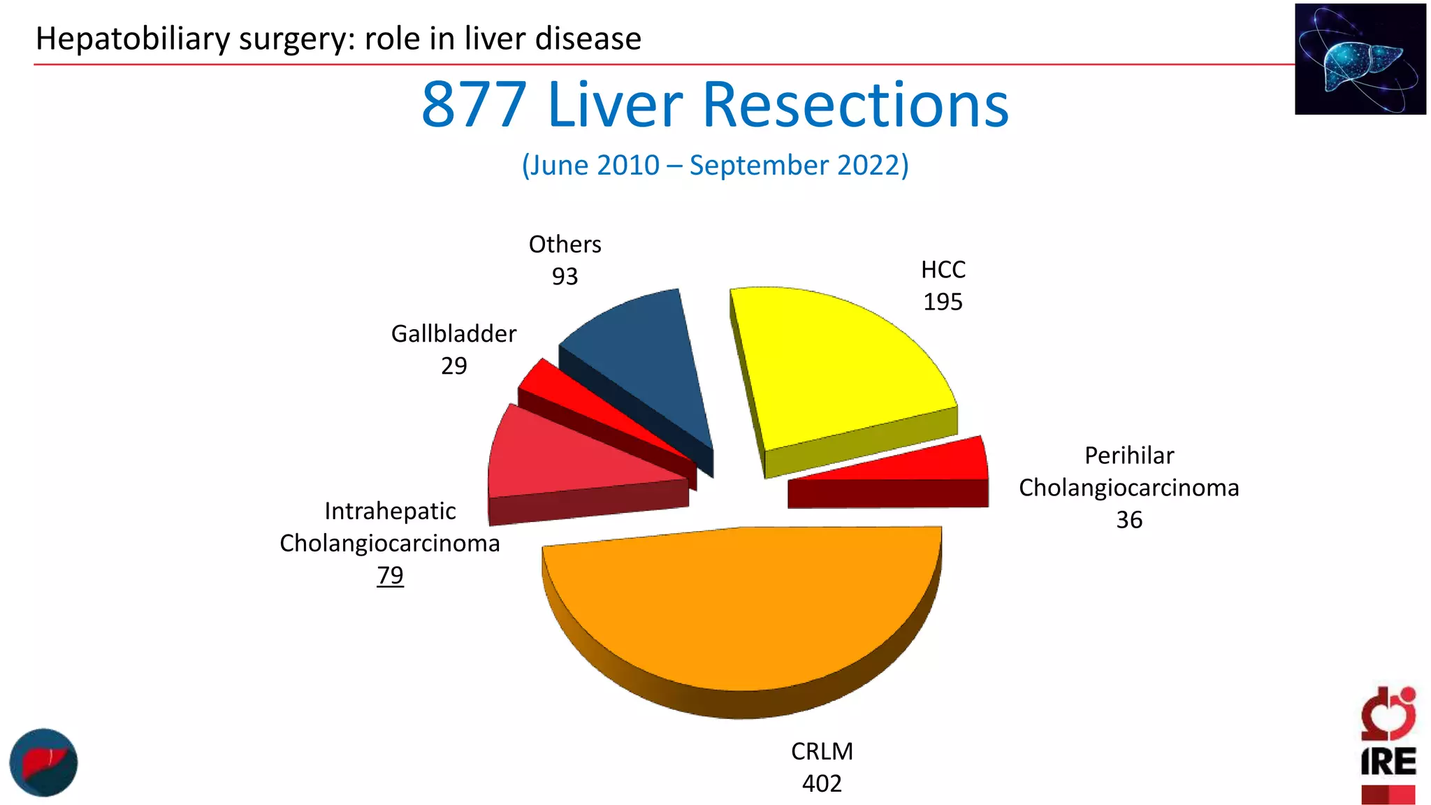 Hepatobiliary surgery - role in liver diseases.pptx