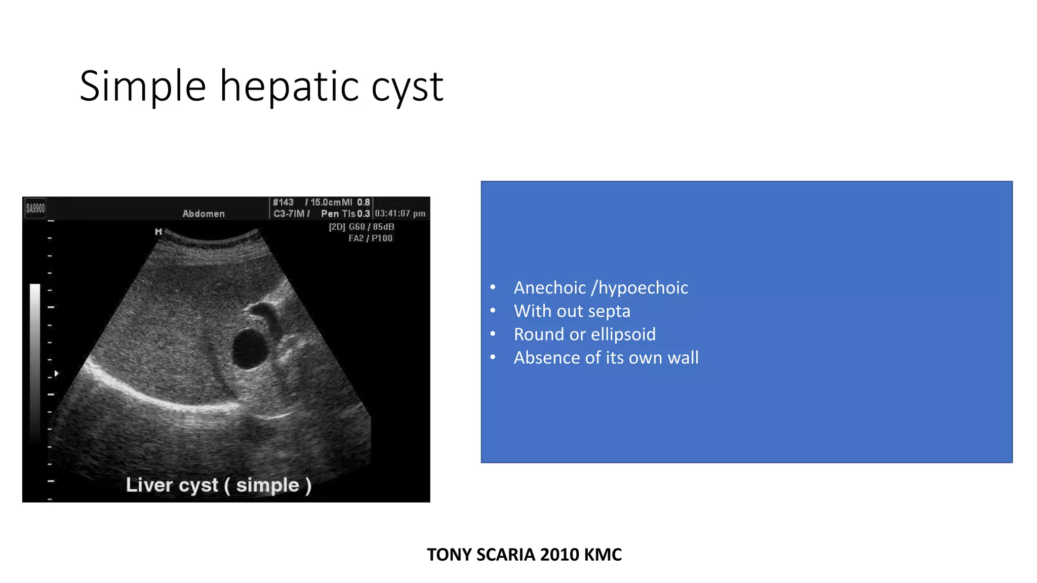 Hepatobiliary system radiology revision notes | PDF