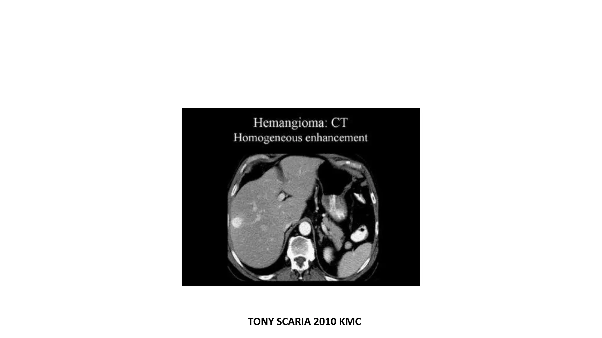 Hepatobiliary system radiology revision notes | PDF