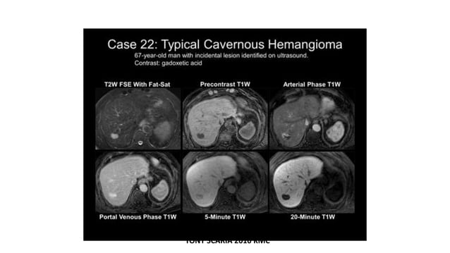 Hepatobiliary system radiology revision notes | PDF