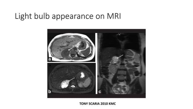 Hepatobiliary system radiology revision notes | PDF