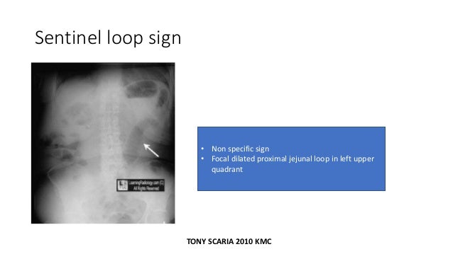 Hepatobiliary system radiology revision notes