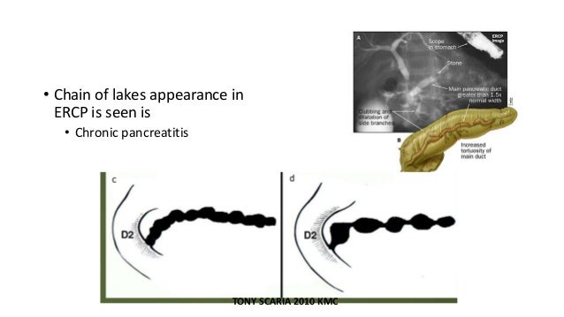 Hepatobiliary system radiology revision notes