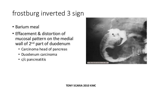 Hepatobiliary system radiology revision notes