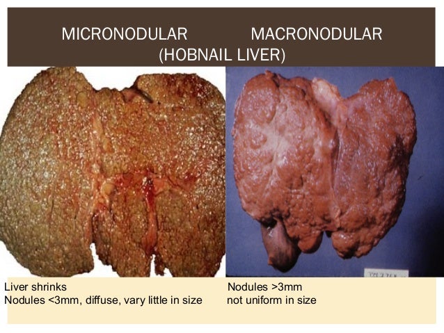 Hepatobiliary system Dr. Snehal Kosale