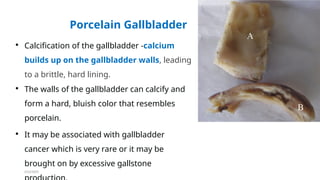 Hepatobiliary System RADIOLOGICAL PATHOLOGY.pptx