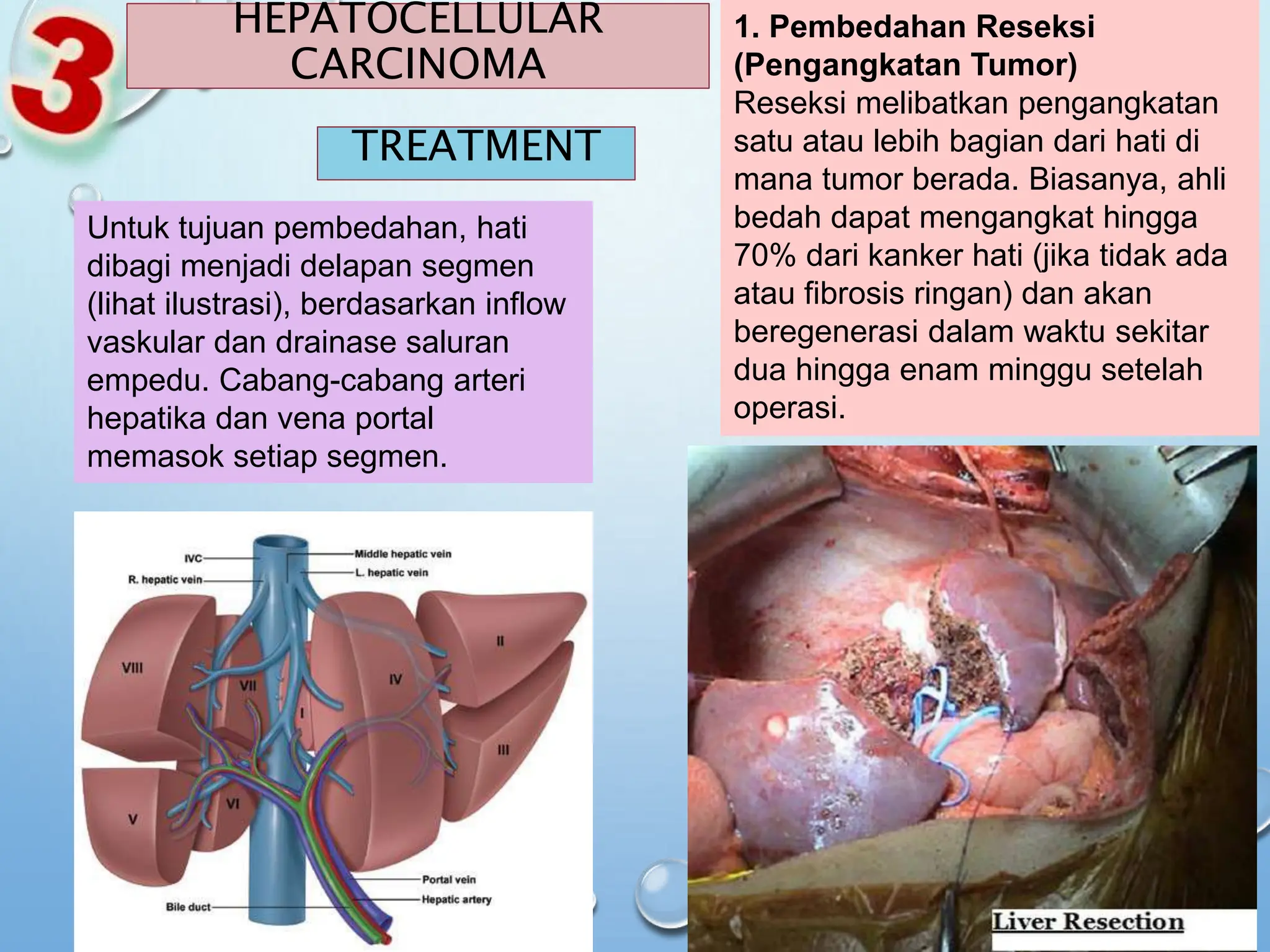 HEPATOBILIERPANCREATIC disease management | PPTX