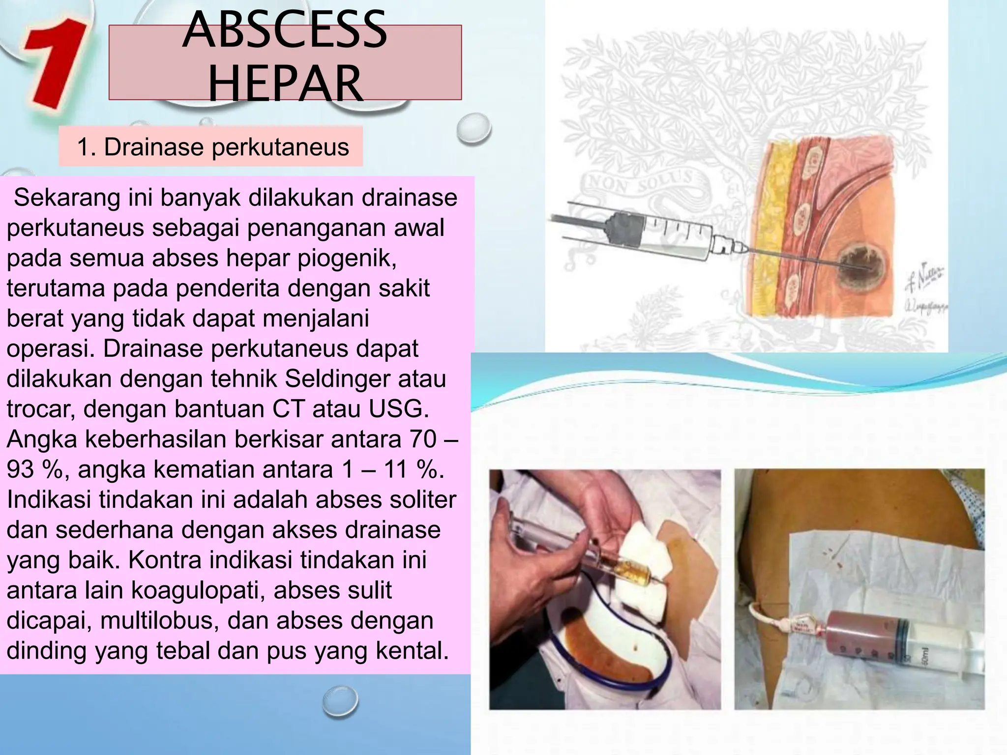 HEPATOBILIERPANCREATIC disease management | PPTX