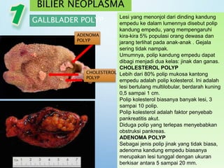 HEPATOBILIERPANCREATIC disease management | PPTX