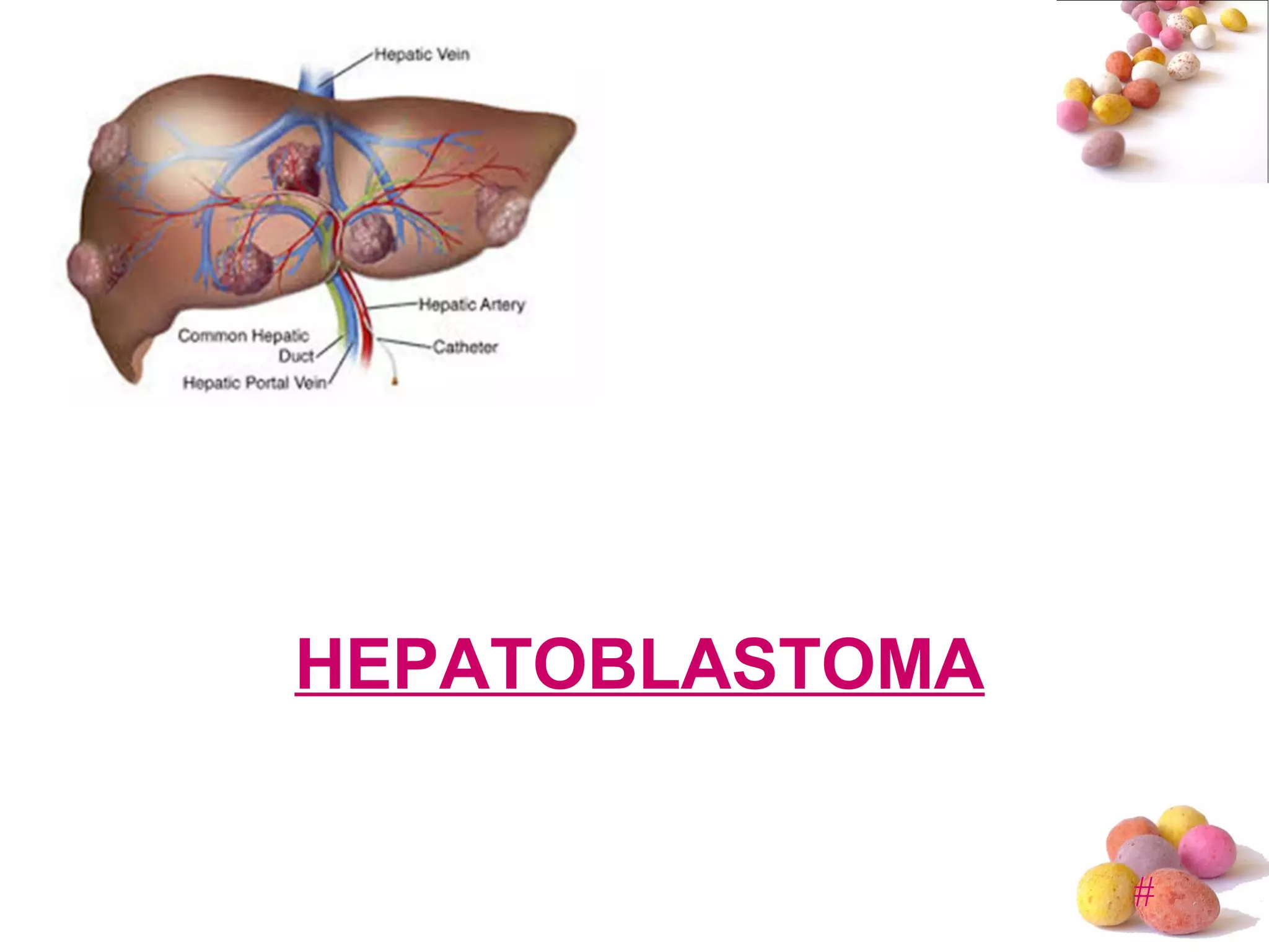 care of children with Hepatoblastoma and bone tumor | PPT