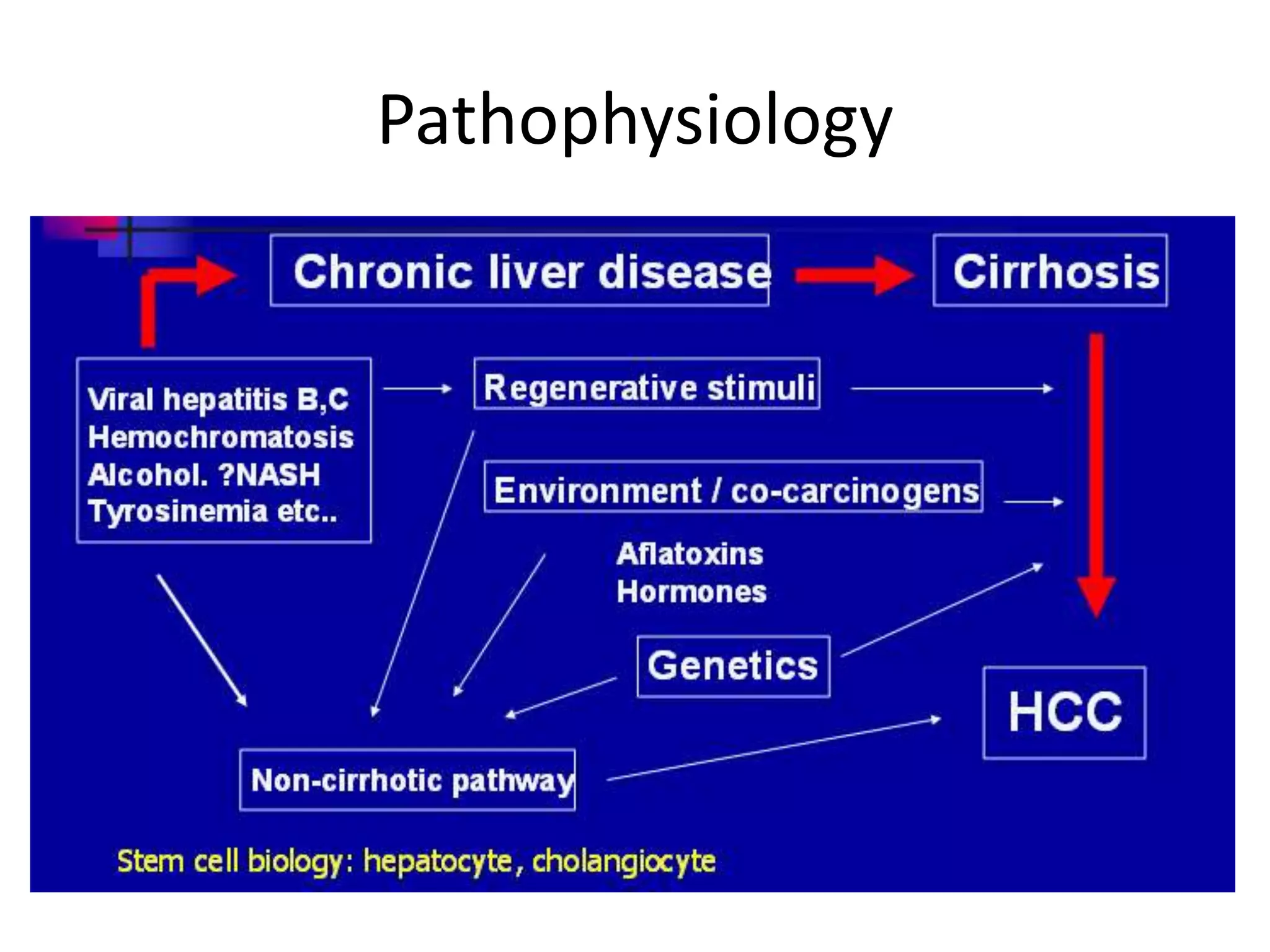 Hepatocellular carcinoma | PPT