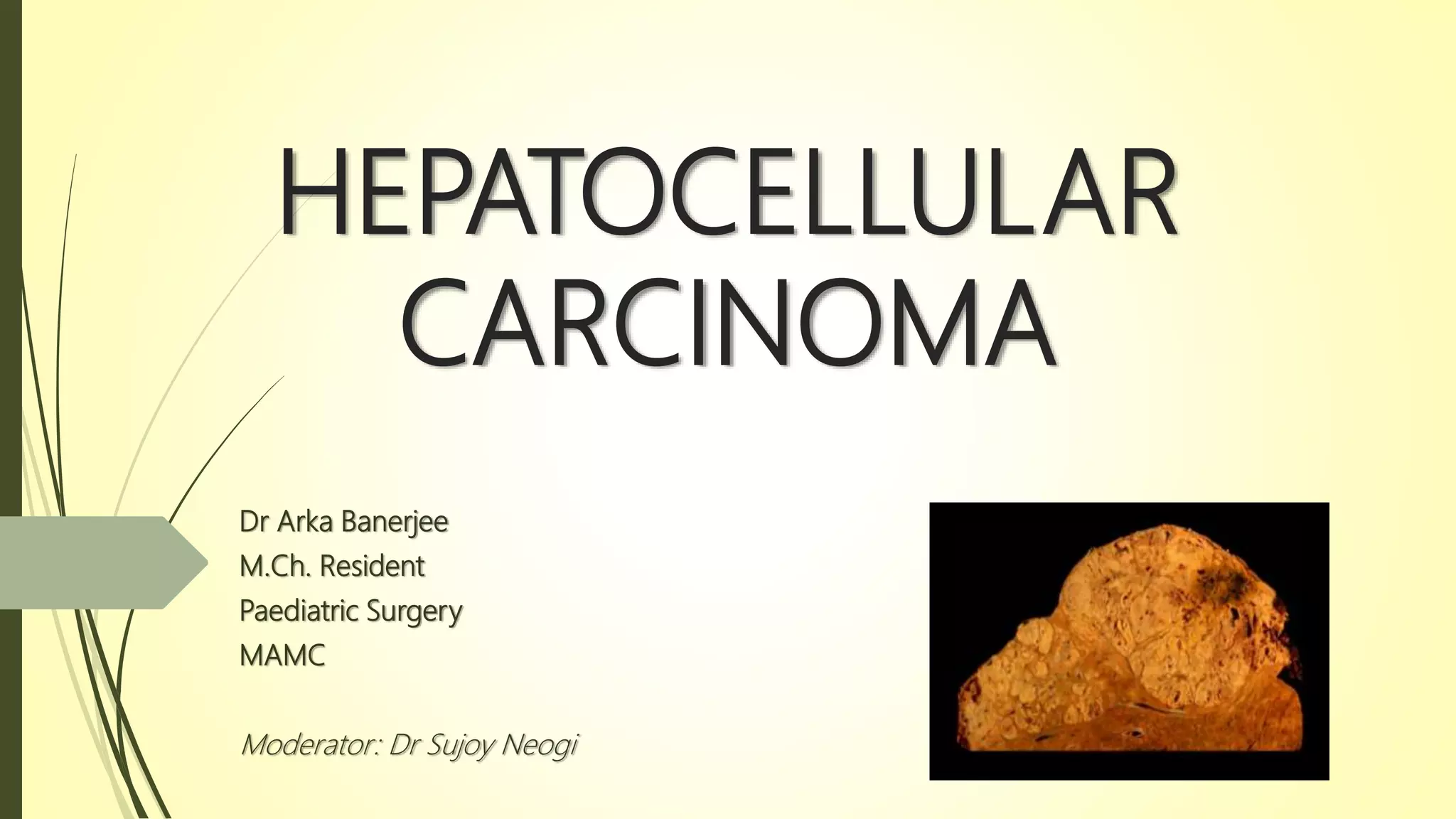 Paediatric Hepatocellular carcinoma | PPT