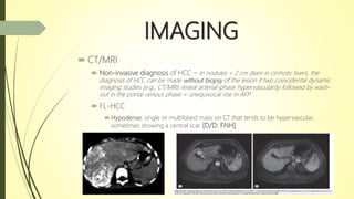 Paediatric Hepatocellular carcinoma | PPTX
