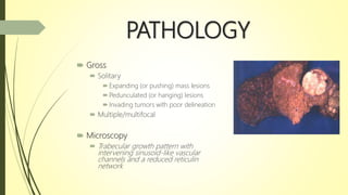 Paediatric Hepatocellular carcinoma | PPTX