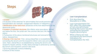 Hepatocellular carcinoma | PPTX