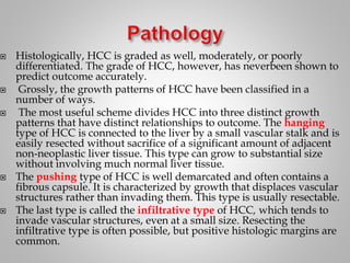 Hepatocellular carcinoma | PPTX