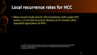 Hepatocellular carcinoma—role of interventional radiologist Dr ...