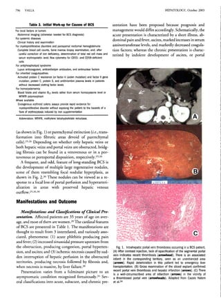 Hepatology - 2007 - Valla - The diagnosis and management of the Budd ...