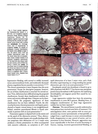 Hepatology - 2007 - Valla - The diagnosis and management of the Budd ...