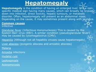 Hepatomegaly | PPTX
