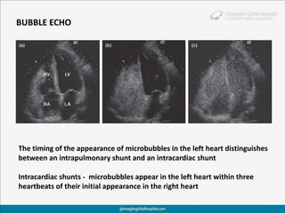 Hepatopulmonary syndrome by Albin Joseph | PPTX
