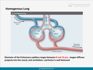 Hepatopulmonary syndrome by Albin Joseph | PPTX