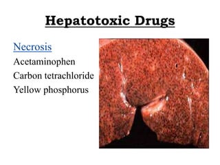 Hepatotoxic drugs | PPT
