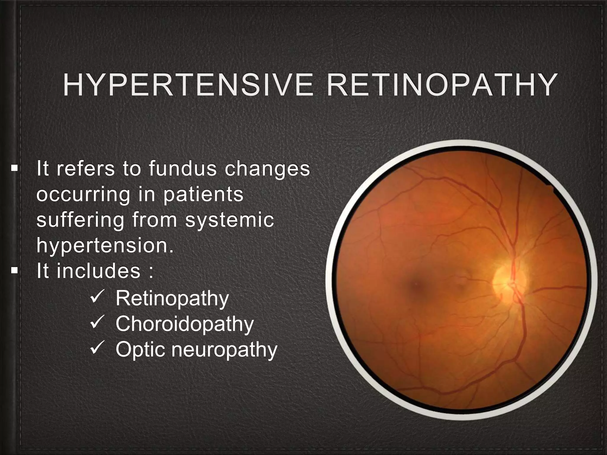 Hepertensive retinopathy , CENTRAL RETINAL ARTERY OCCLUSION ,CENTRAL ...