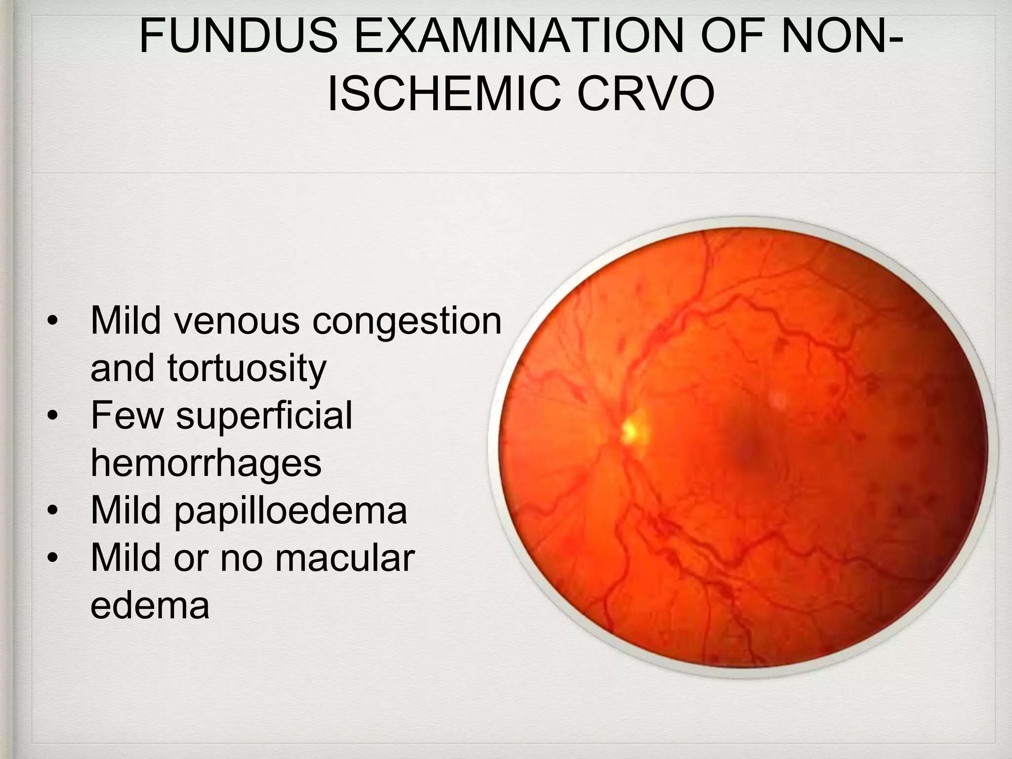 Hepertensive retinopathy , CENTRAL RETINAL ARTERY OCCLUSION ,CENTRAL ...