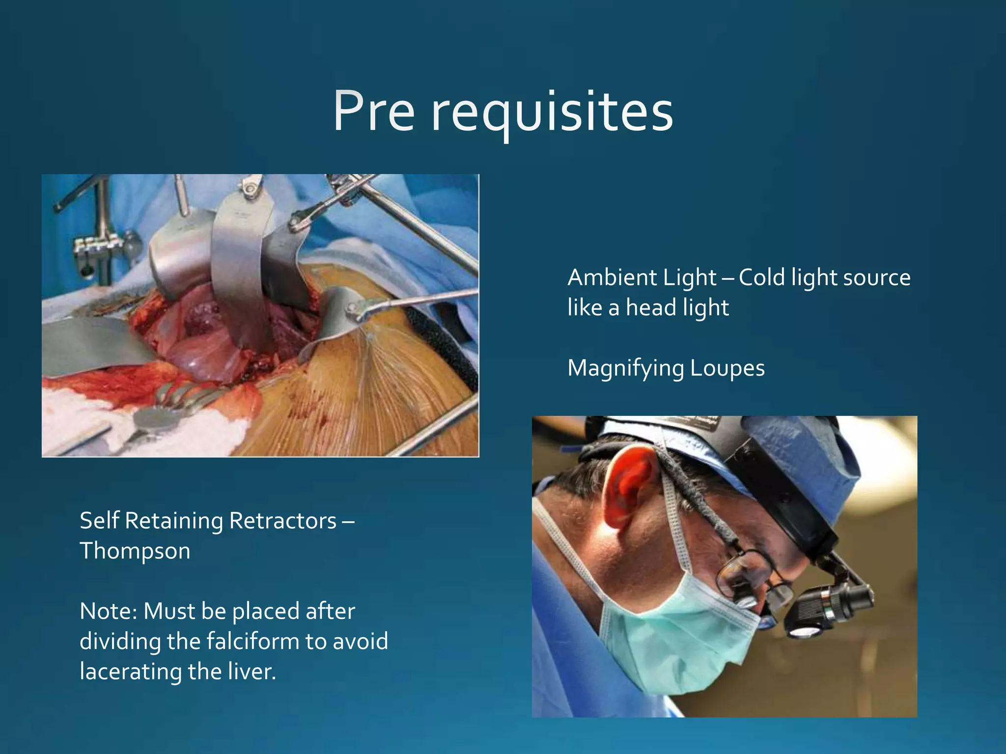 Biliary Anatomy and Reconstruction of the Biliary Tract | PPTX