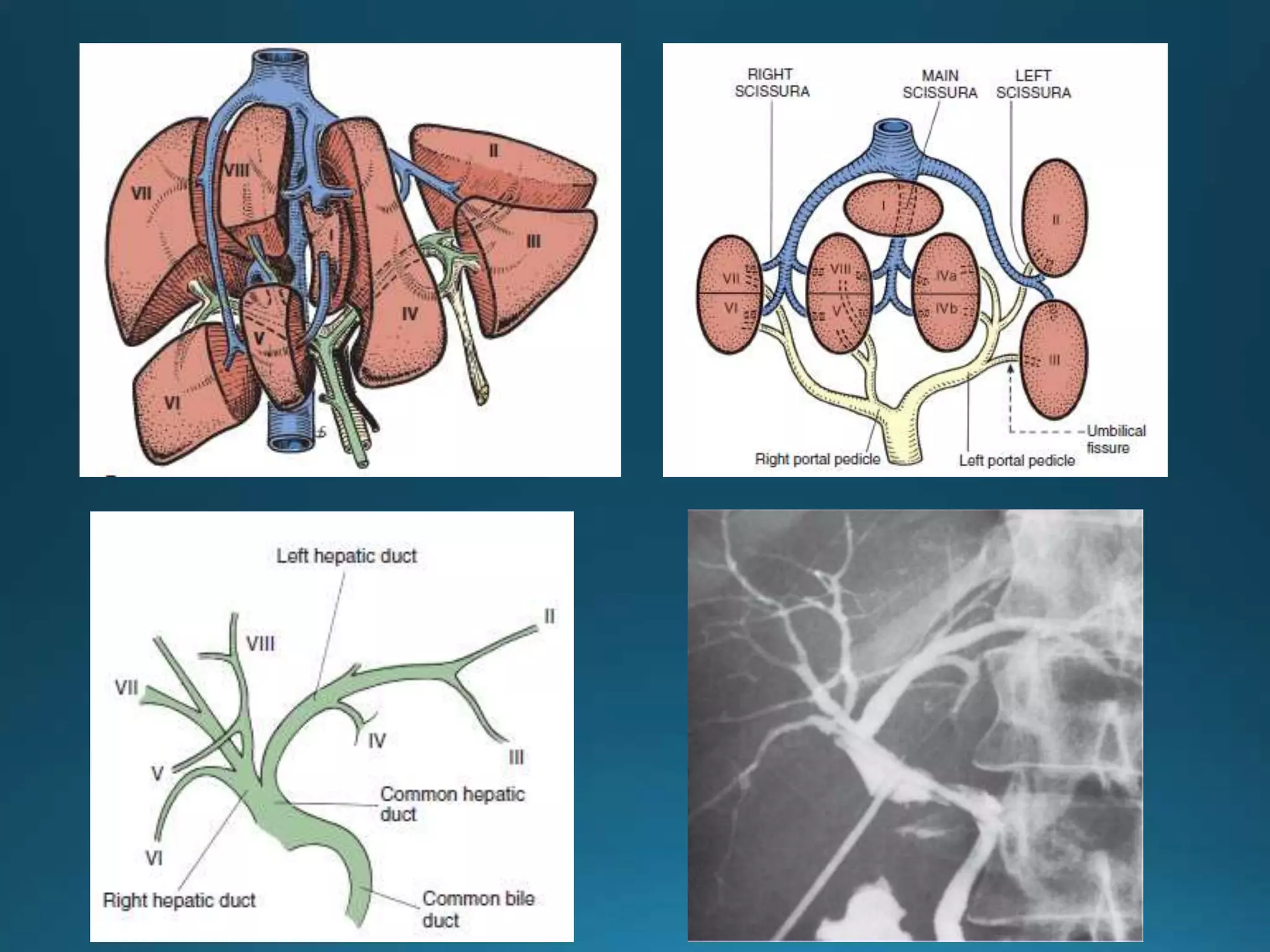 Biliary Anatomy and Reconstruction of the Biliary Tract | PPTX
