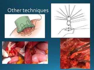 Biliary Anatomy and Reconstruction of the Biliary Tract | PPTX