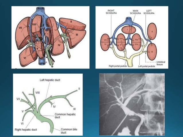 Biliary Anatomy and Reconstruction of the Biliary Tract | PPT