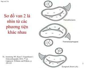 Hepvan2la | PPT