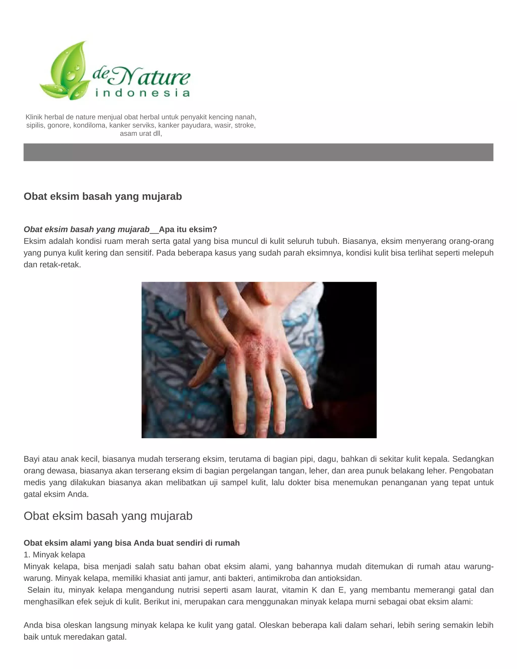 obat eksim basah yang mujarab | PDF