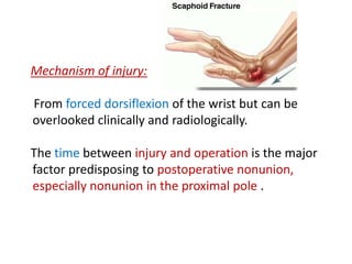 Herbert screw fixation and bone graft in nonunited scaphoid | PPTX