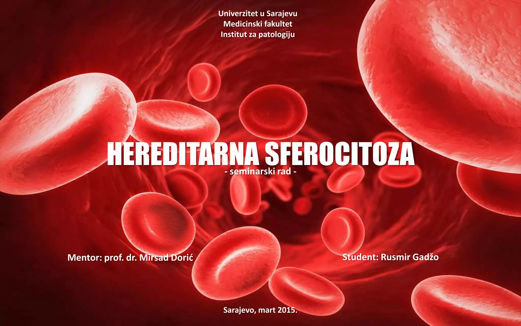 Hereditarna sferocitoza | PPTX