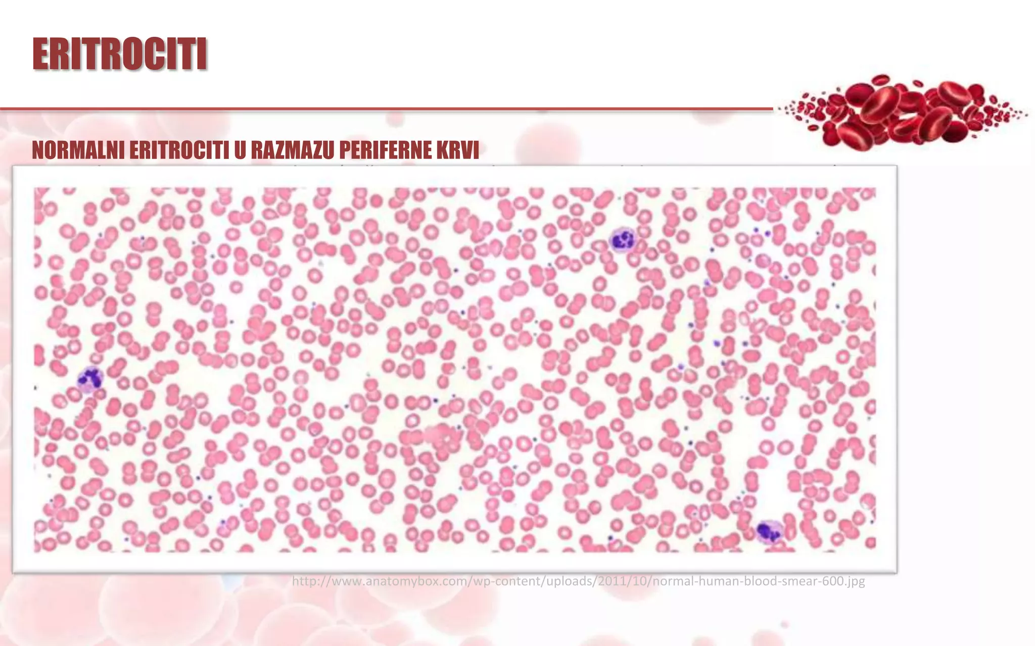 Hereditarna sferocitoza | PPTX