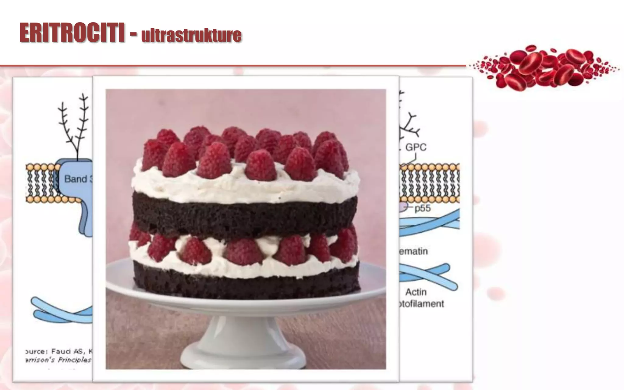 Hereditarna sferocitoza | PPTX