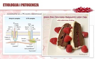 Hereditarna sferocitoza | PPTX