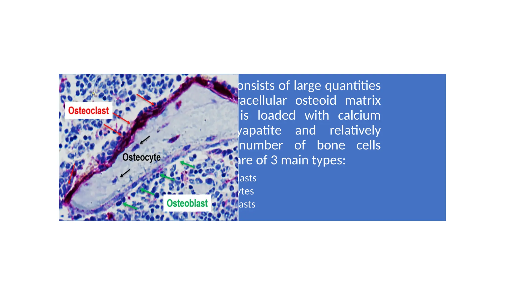 HEREDITARY AND METABOLIC DISEASE OF BONE OSTEOMYELITIS | PPTX