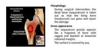 HEREDITARY AND METABOLIC DISEASE OF BONE OSTEOMYELITIS | PPTX