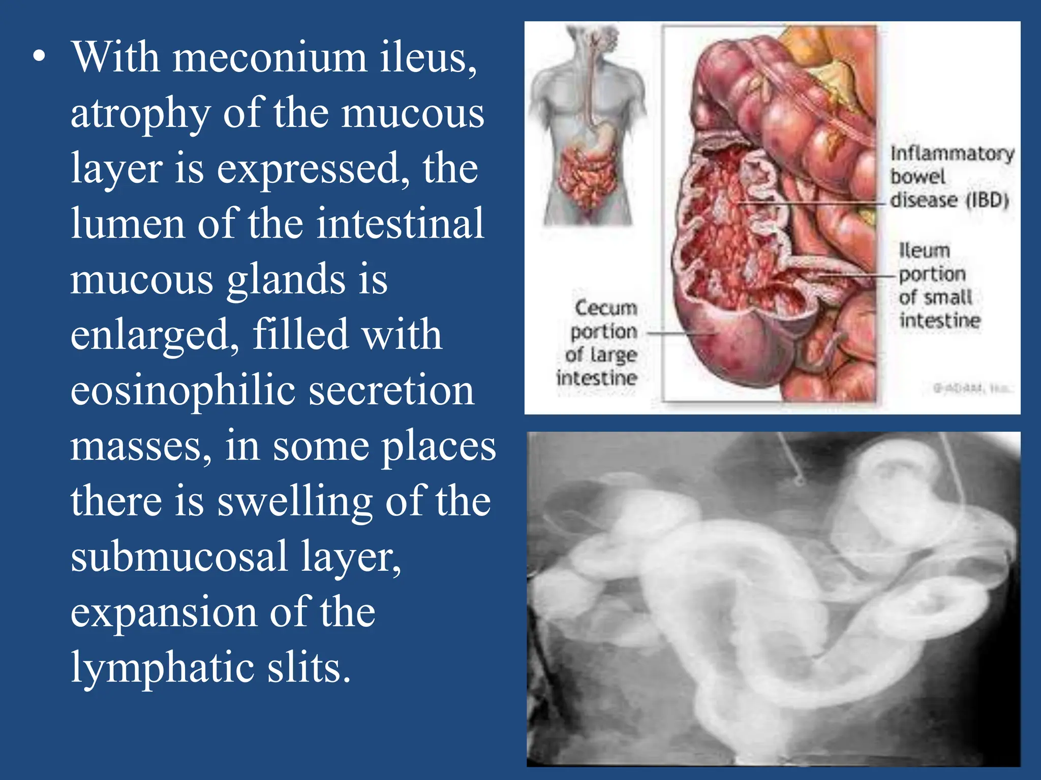 hereditary diseases of carbohydrate metabolism.ppt
