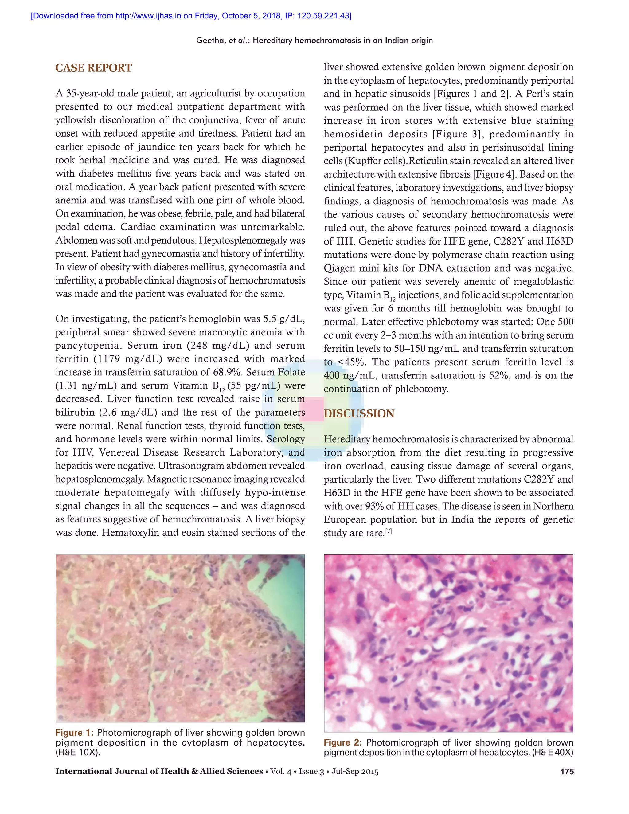 Hereditary hemochromatosis | PDF