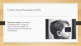 Approach to a patient with HEREDITARY NEUROPATHY cases | PPT