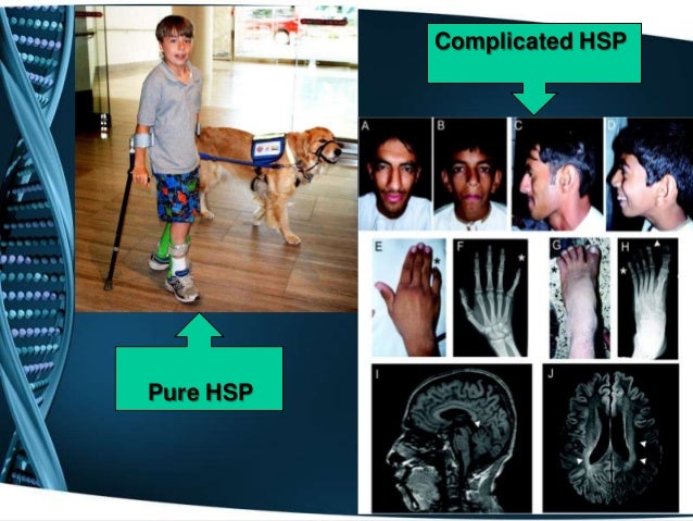 Hereditary spastic paraplegia