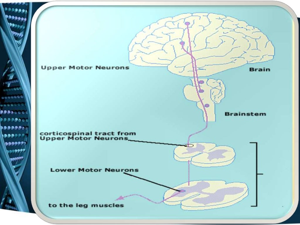 Hereditary spastic paraplegia