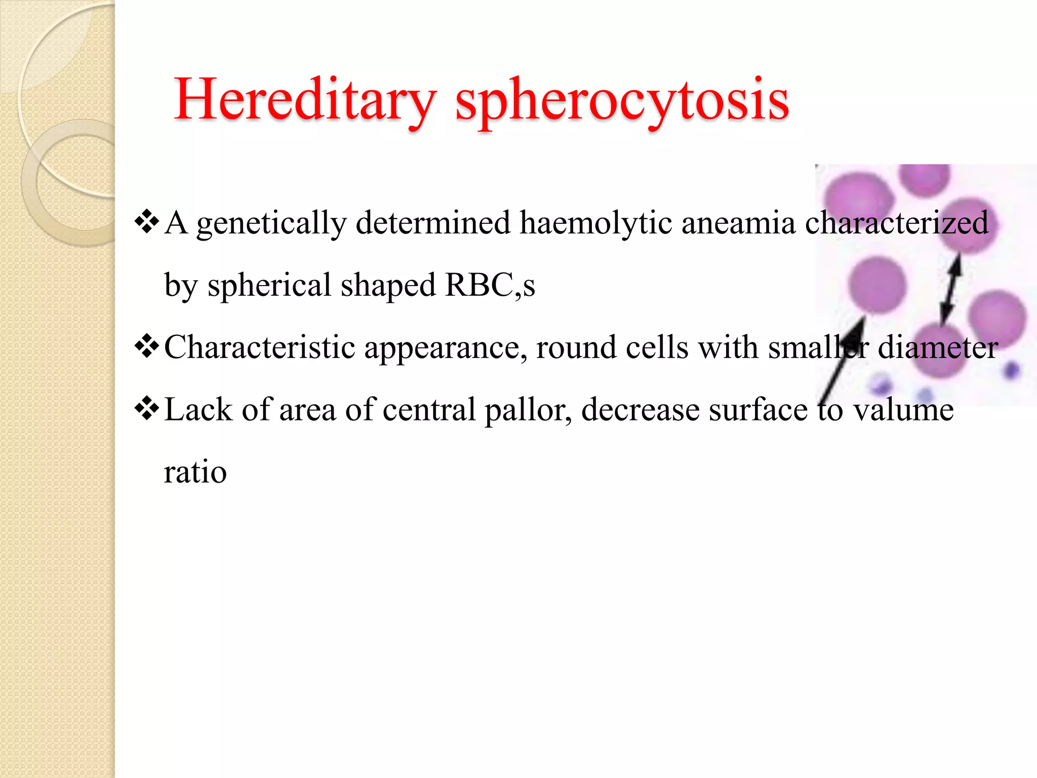 Hereditary spherocytosis | PDF