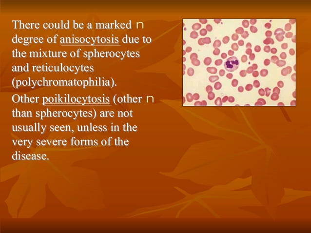 Hereditary spherocytosis | PPT