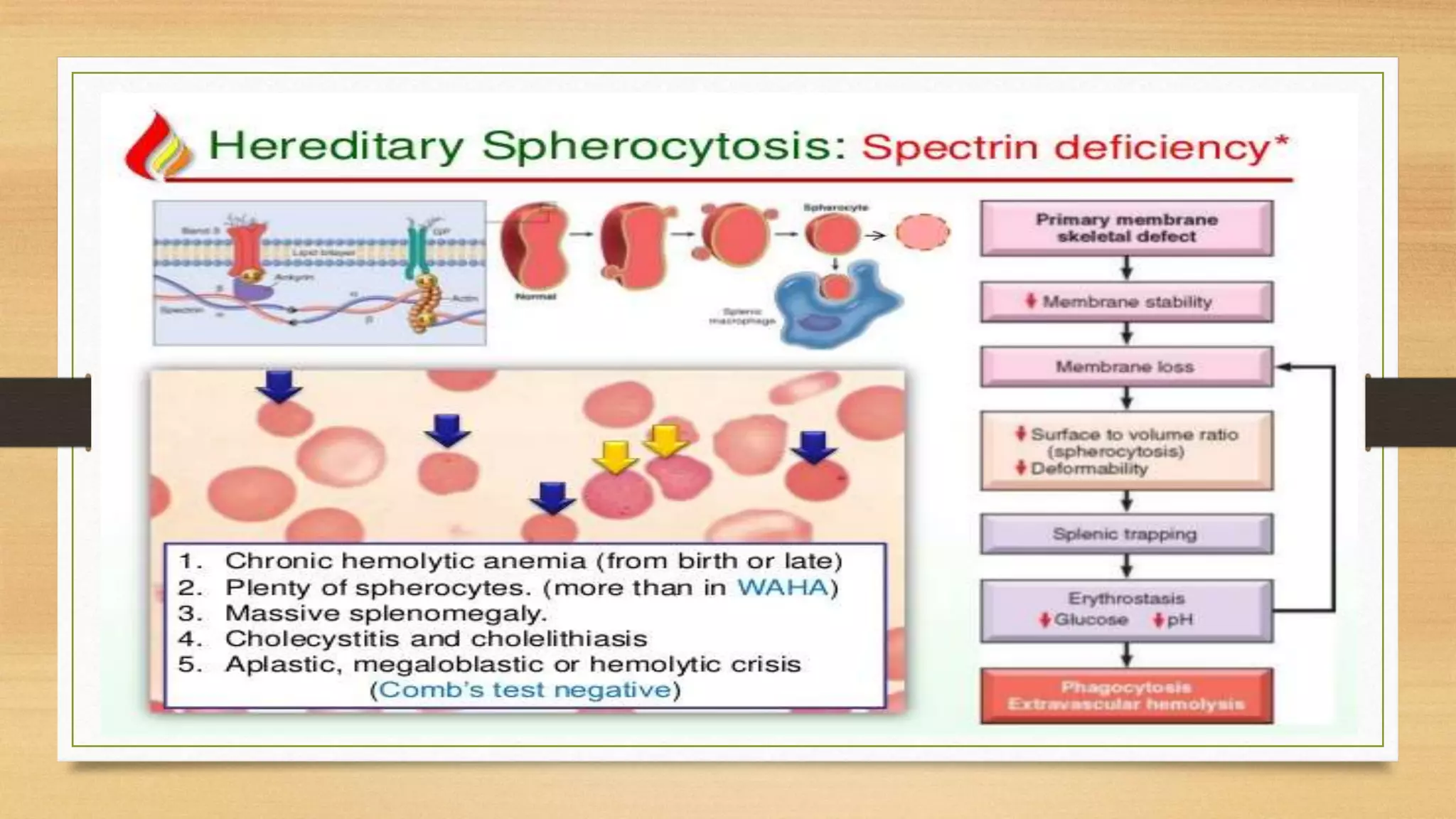Hereditary spherocytosis | PPTX